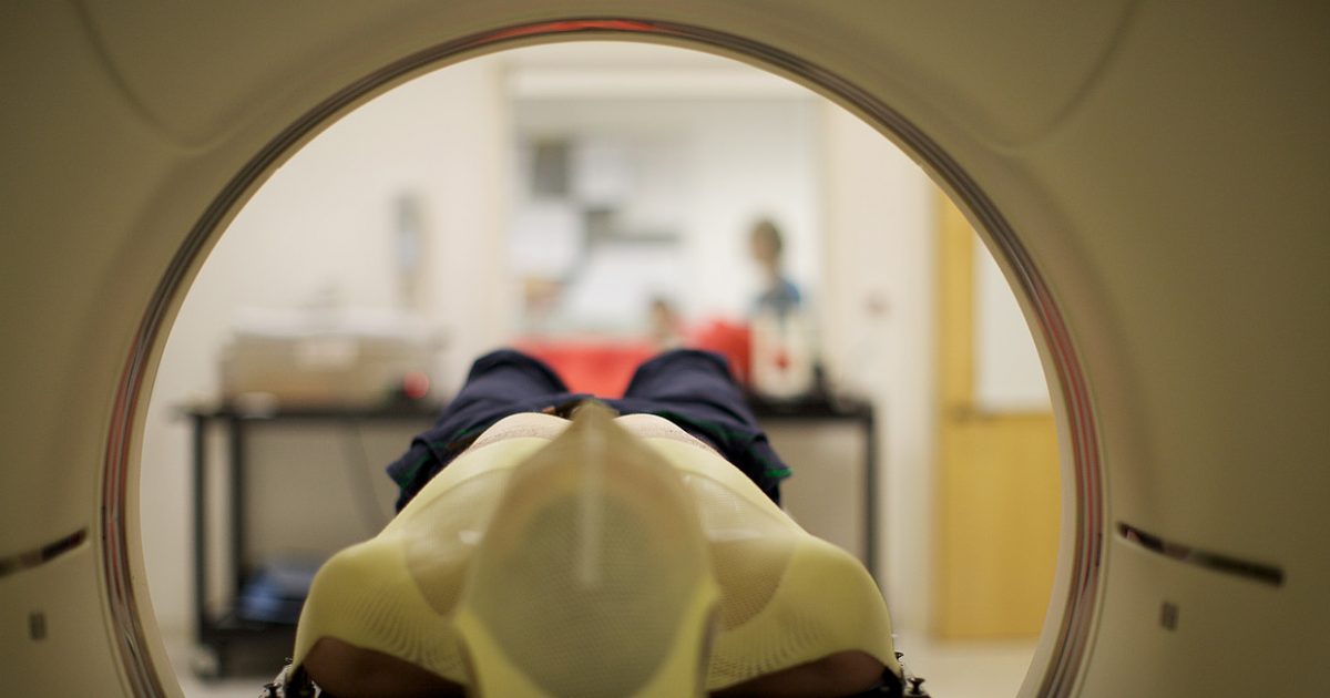 Using MRI scans to help diagnose prostate cancer - ARC West